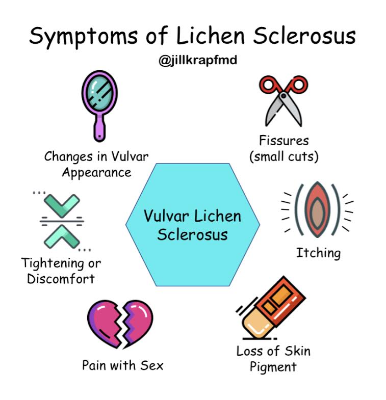 Vulvar Lichen Sclerosus It S Not Just Itching Jill Krapf Md